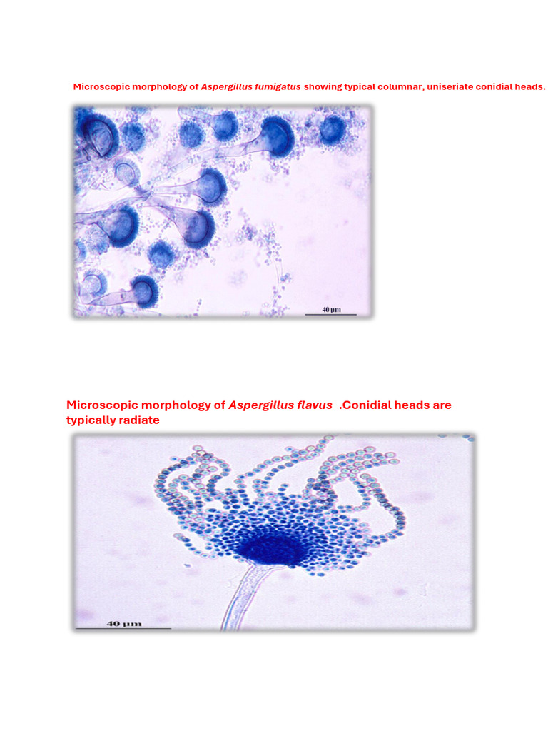 Aspergillus Species Microscopic Morphology | PDF
