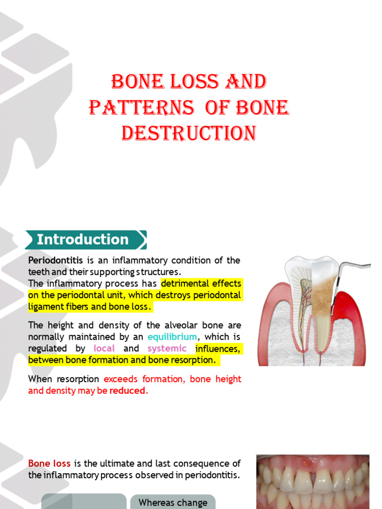 Understanding Bone Loss in Periodontitis | PDF | Periodontology | Bone