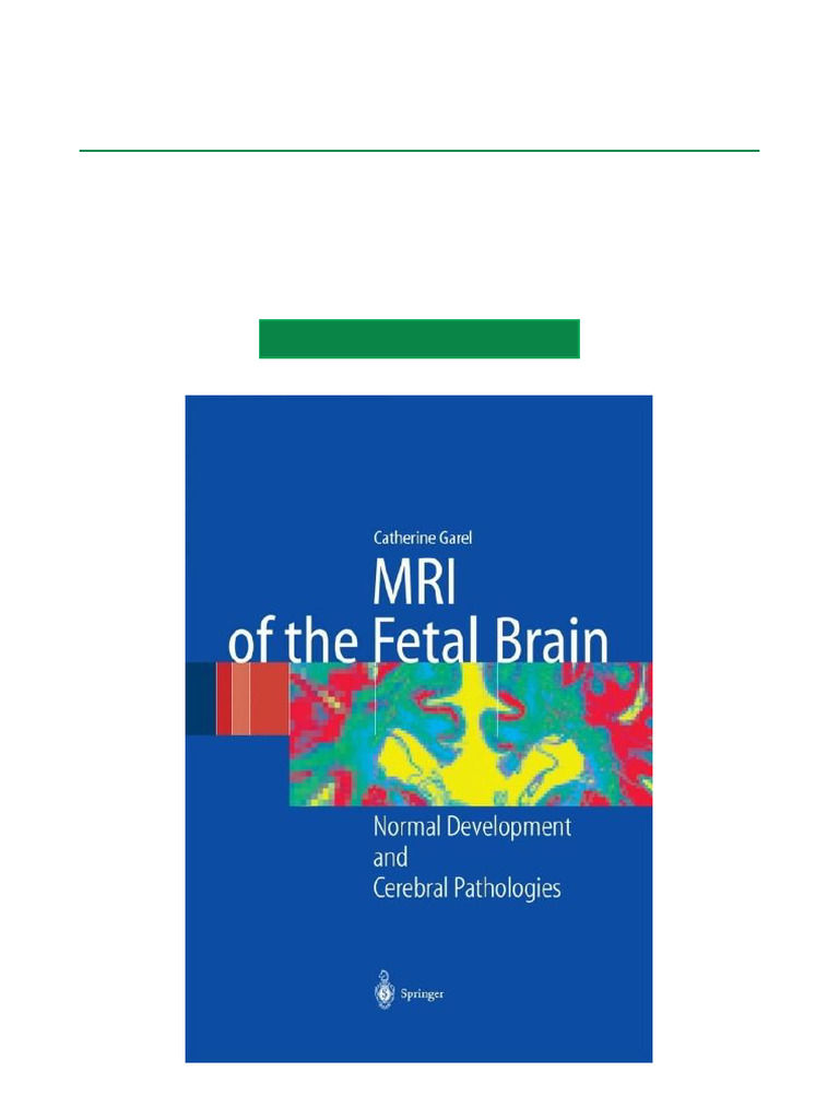 MRI of The Fetal Brain Normal Development and Cerebral Pathologies Free ...