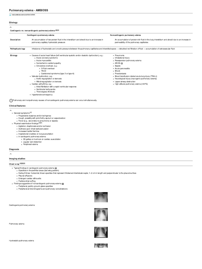 Pulmonary Edema - AMBOSS | PDF