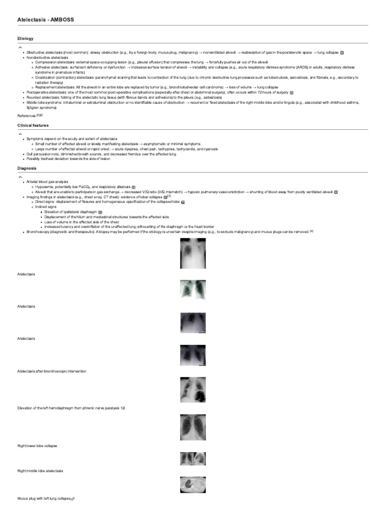 Atelectasis - AMBOSS | PDF
