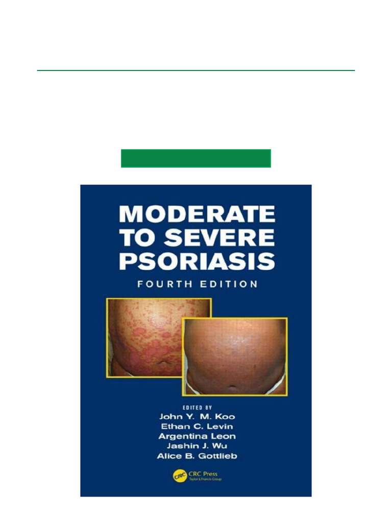 Mild To Moderate and Moderate To Severe Psoriasis (Set) 1st Edition Entire Volume Download | PDF ...