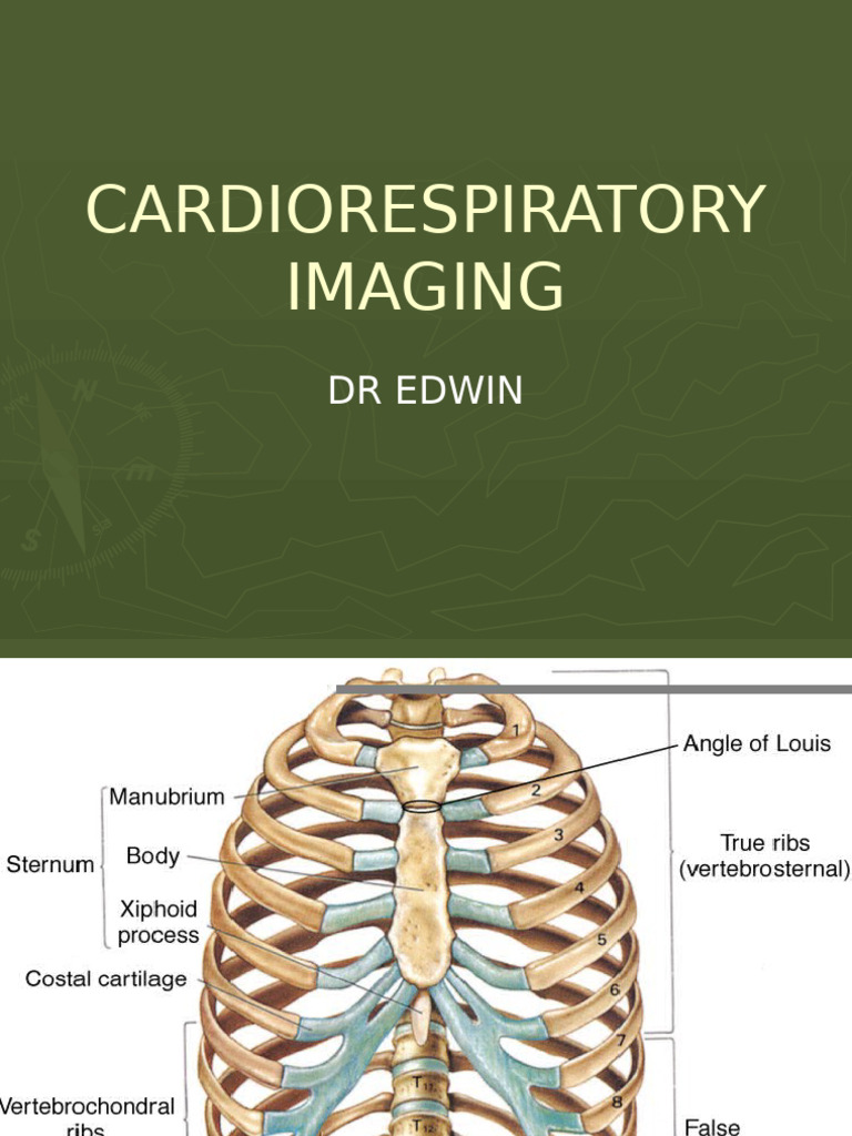 Cardiorespiratory Imaging I | PDF | Thorax | Lung