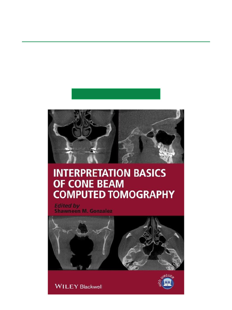 Interpretation Basics of Cone Beam Computed Tomography - 1st Edition ...