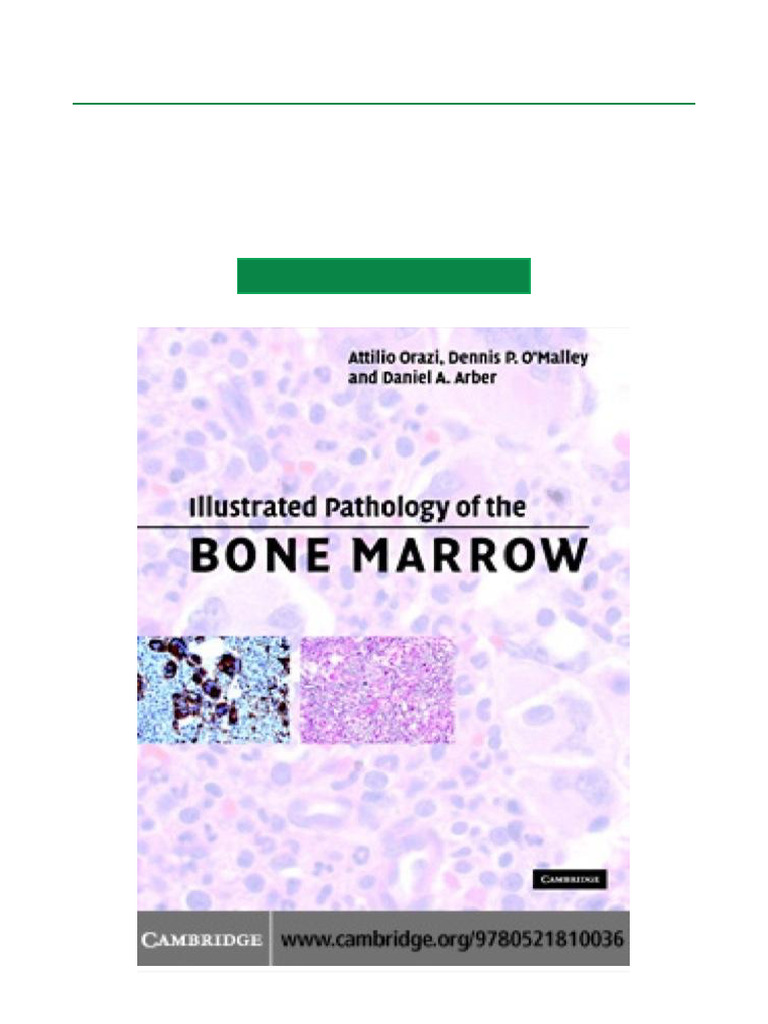 Illustrated Bone Marrow Pathology Guide | PDF | Leukemia | Biopsy