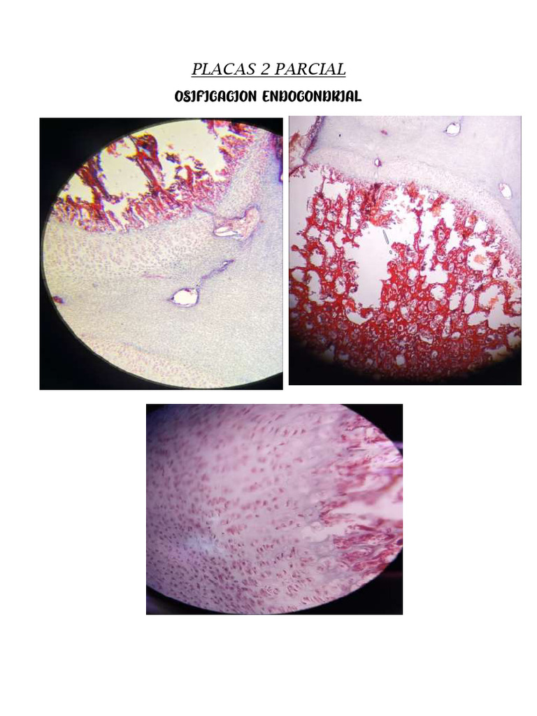 Placa 2 Parcial Micro | PDF | Epitelio | Hueso