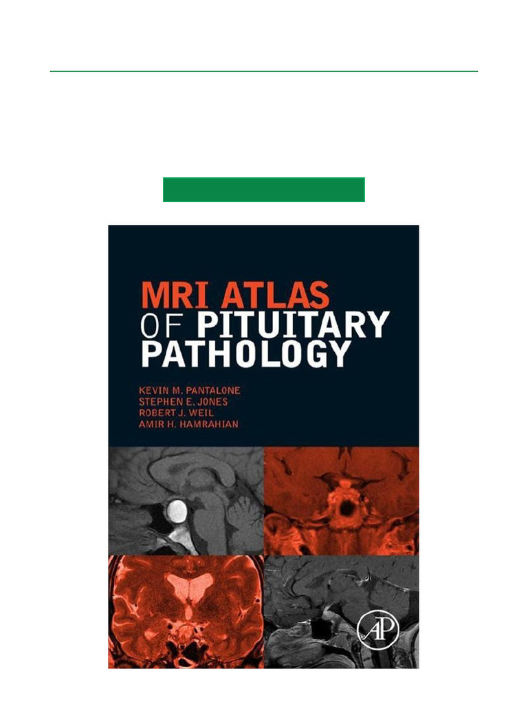 MRI Atlas of Pituitary Pathology FULL PDF DOCX DOWNLOAD | PDF | Pituitary Gland | Magnetic ...