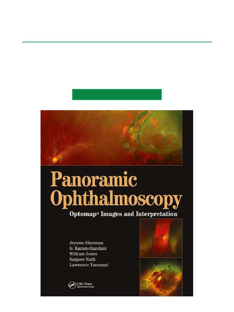 Panoramic Ophthalmoscopy Optomap Images and Interpretation 1st Edition Premium Download | PDF ...