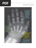Greulich and Pyle's Radiographic Atlas of Skeletal Development of | PDF ...