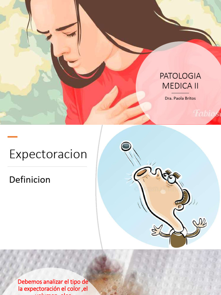 1.3 - Expectoracion | PDF