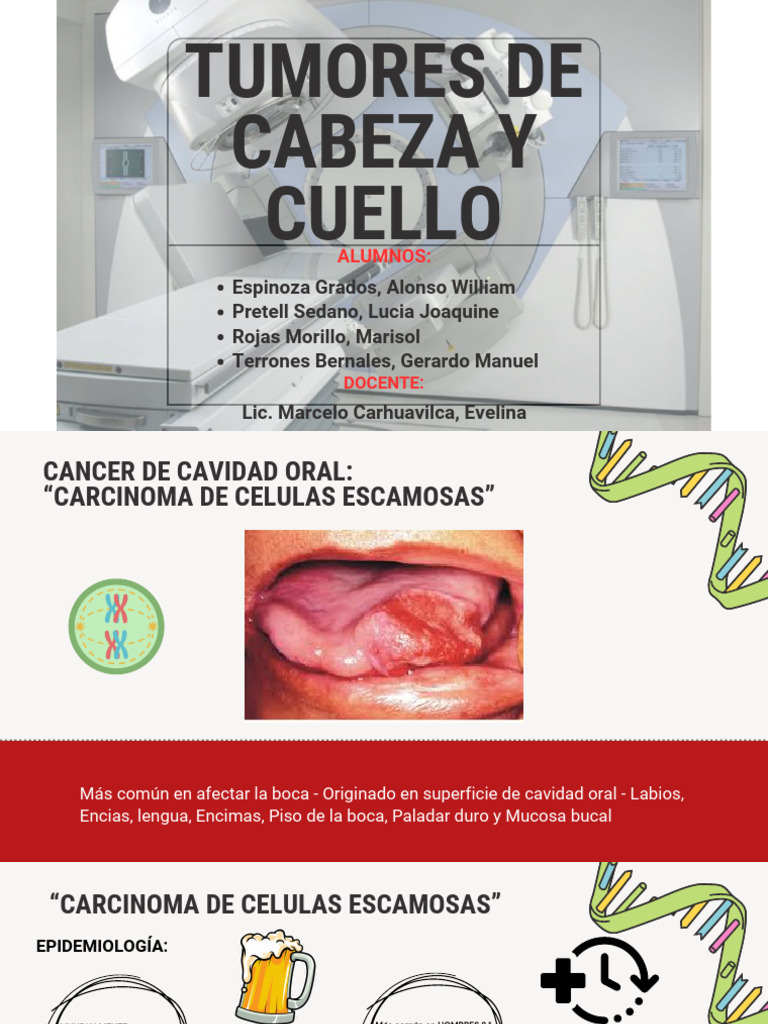 Cabeza y Cuello - Exposición RT 2024 | PDF | Cáncer | Neoplasias