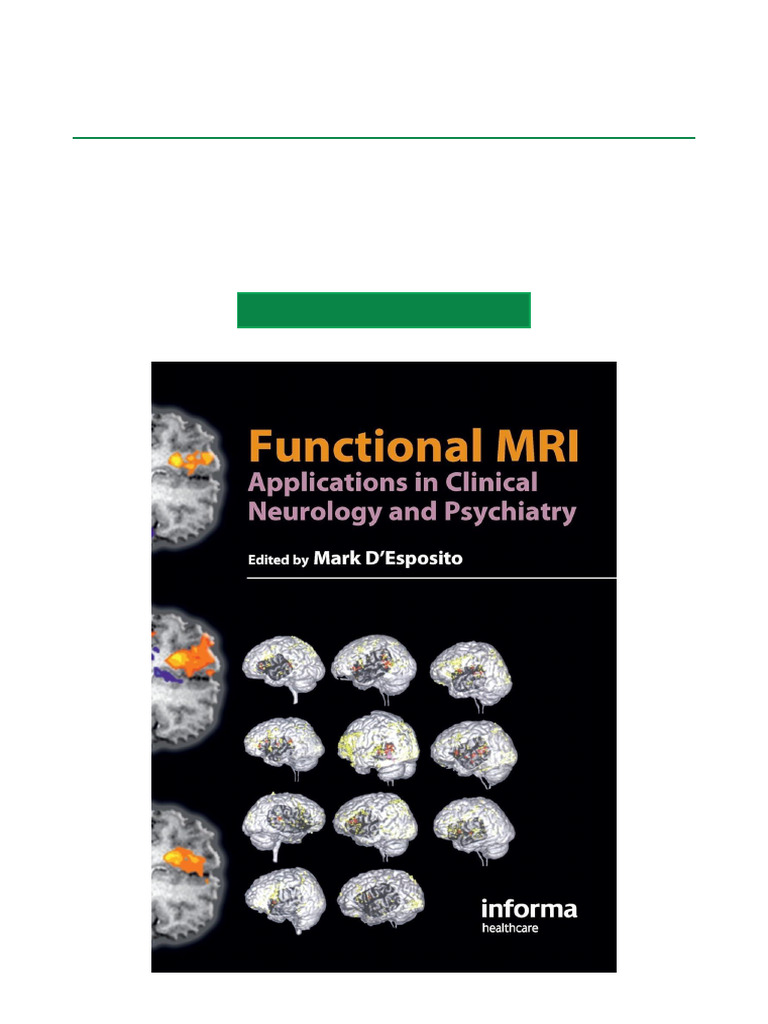 Functional MRI Applications in Clinical Neurology and Psychiatry 1st ...