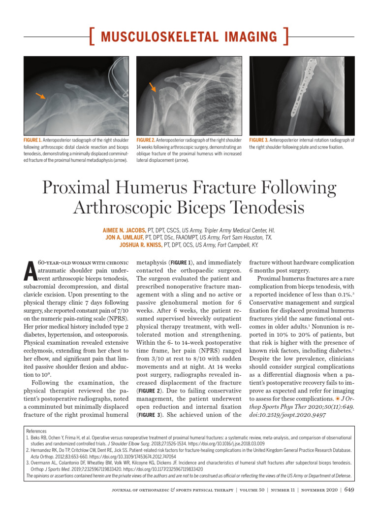 Jacobs Et Al 2020 Proximal Humerus Fracture Following Arthroscopic ...