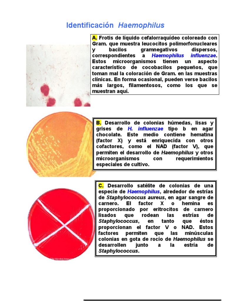Identificación de Especies Haemophilus | Microbiología | Patologia clinica