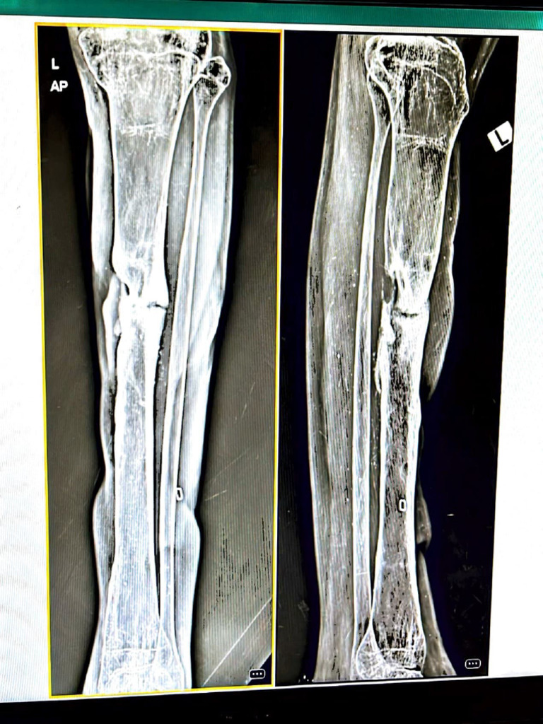 X Ray Pdf