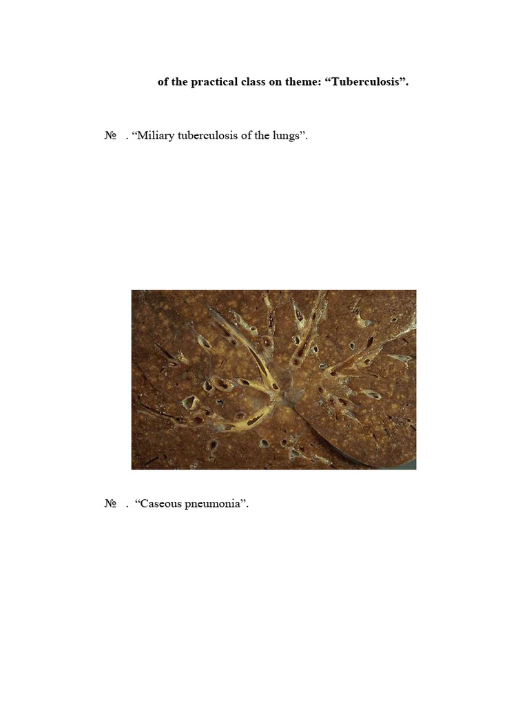 Practical Class 13. Tuberculosis. | PDF