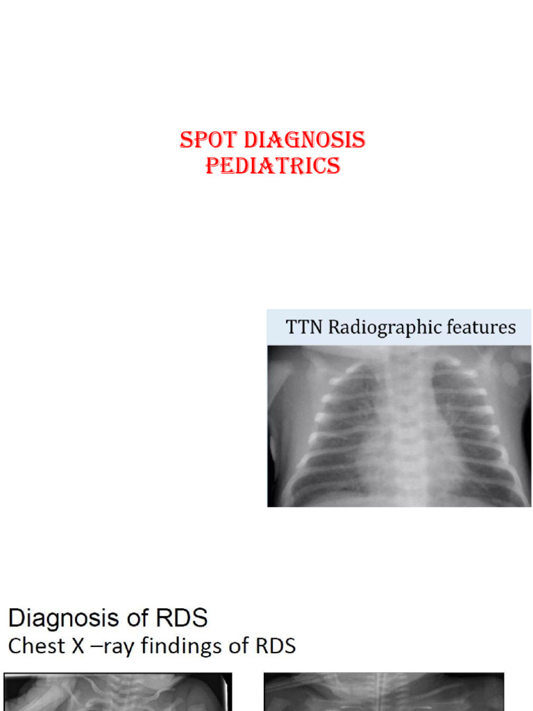 Spot Diagnosis - Pediatrics Module | PDF | Pneumonia | Diseases And ...