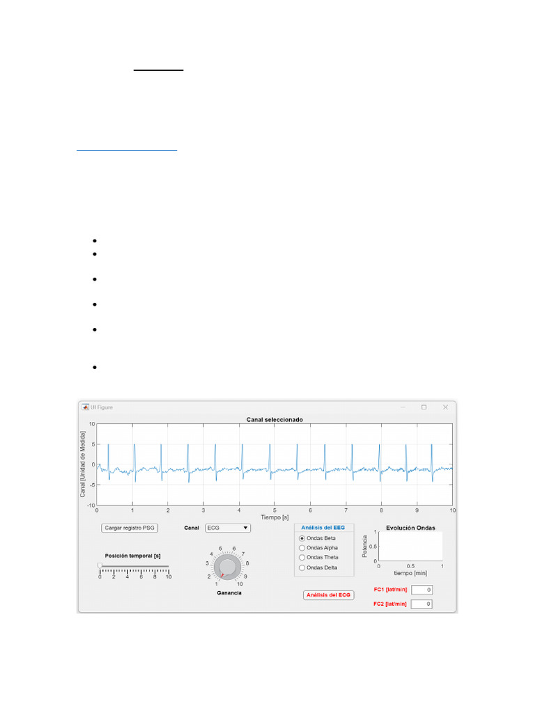 Practica 1 Ed Oct 24 C1 | PDF | Frecuencia | Devolución de llamada (programación de computadora)