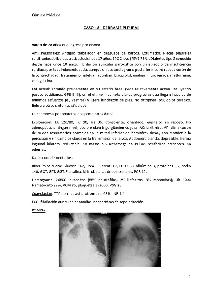 Caso 18. Derrame Pleural | PDF | Biopsia | Embolia