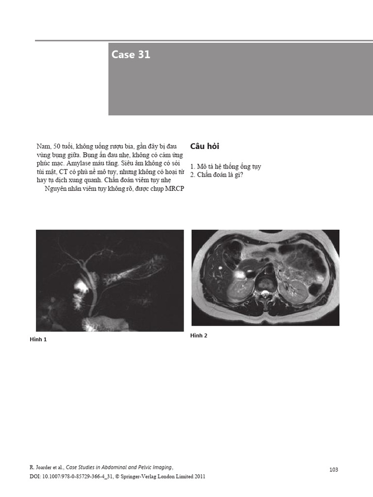 Bai Dich 100 Case Bung 31 40 Cdhainfo | PDF