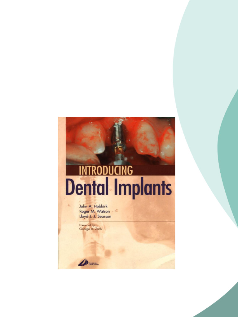 Introducing Dental Implants 1st Edition by John Hobkirk, Roger Watson, Lloyd Searson ...