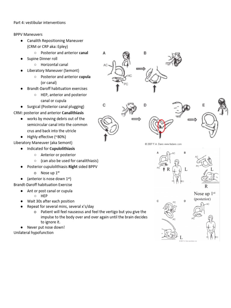 Topic 4 - Vestibular Interventions | PDF | Vestibular System | Sensory Organs
