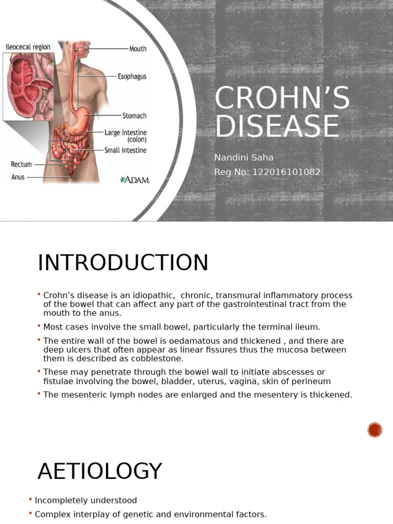 Crohn's Disease Remastered | PDF | Crohn's Disease | Gastrointestinal Tract