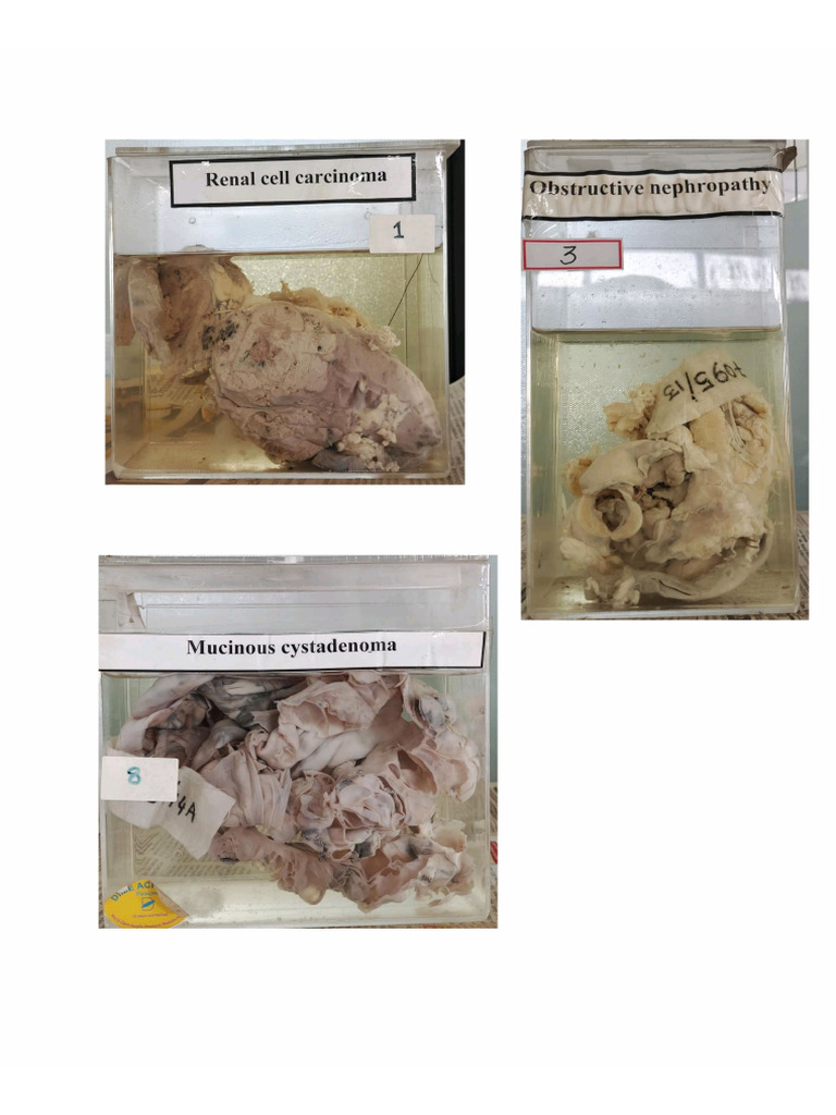 Patho Specimen | PDF