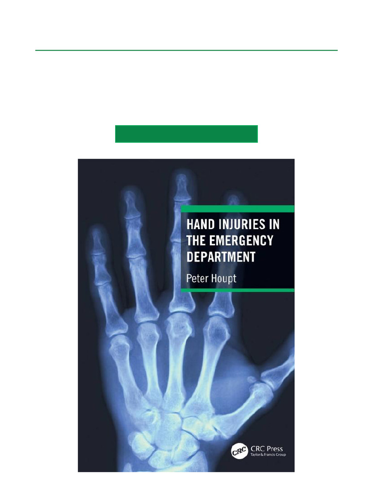 Hand Injuries in The Emergency Department 1st Edition Entire Ebook ...