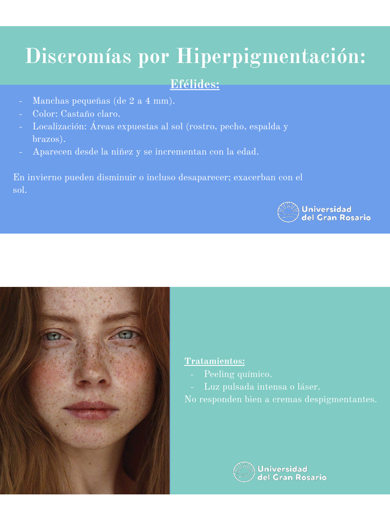 Discromías y Tratamientos de Piel | PDF | Piel | Melanoma