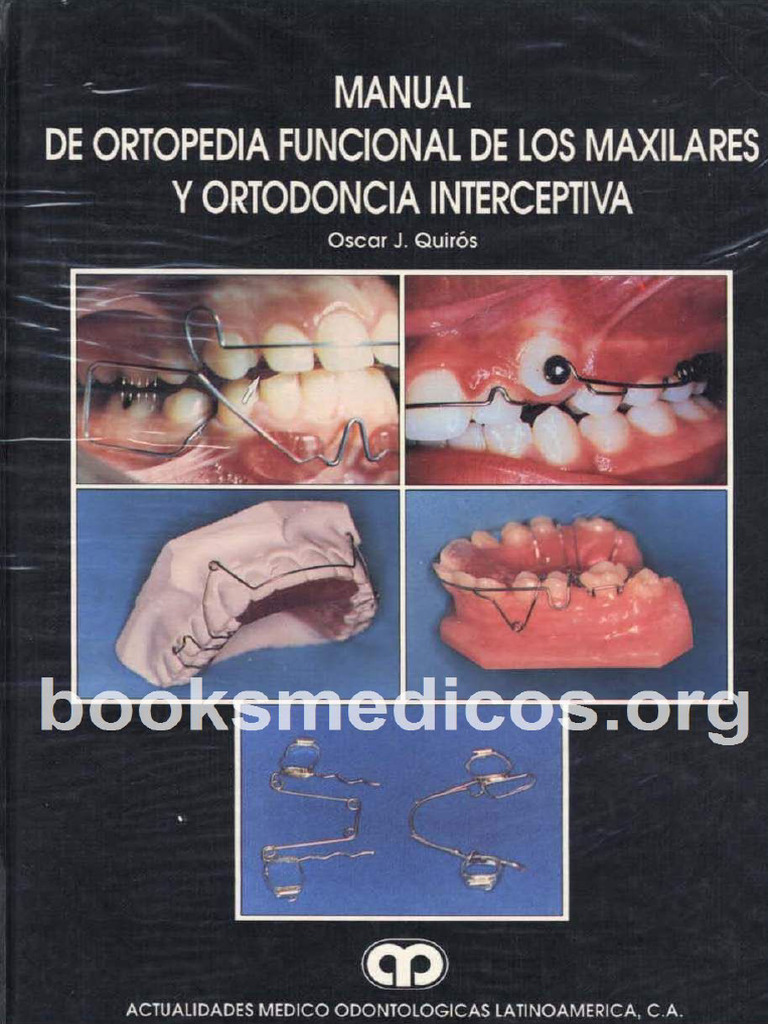 Manual de Ortopedia Funcional de Los Maxilares y Ortodoncia Interceptiva | PDF