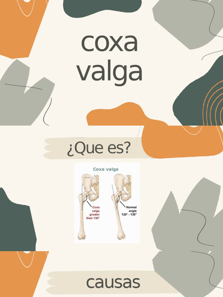 Coxa Valga | PDF