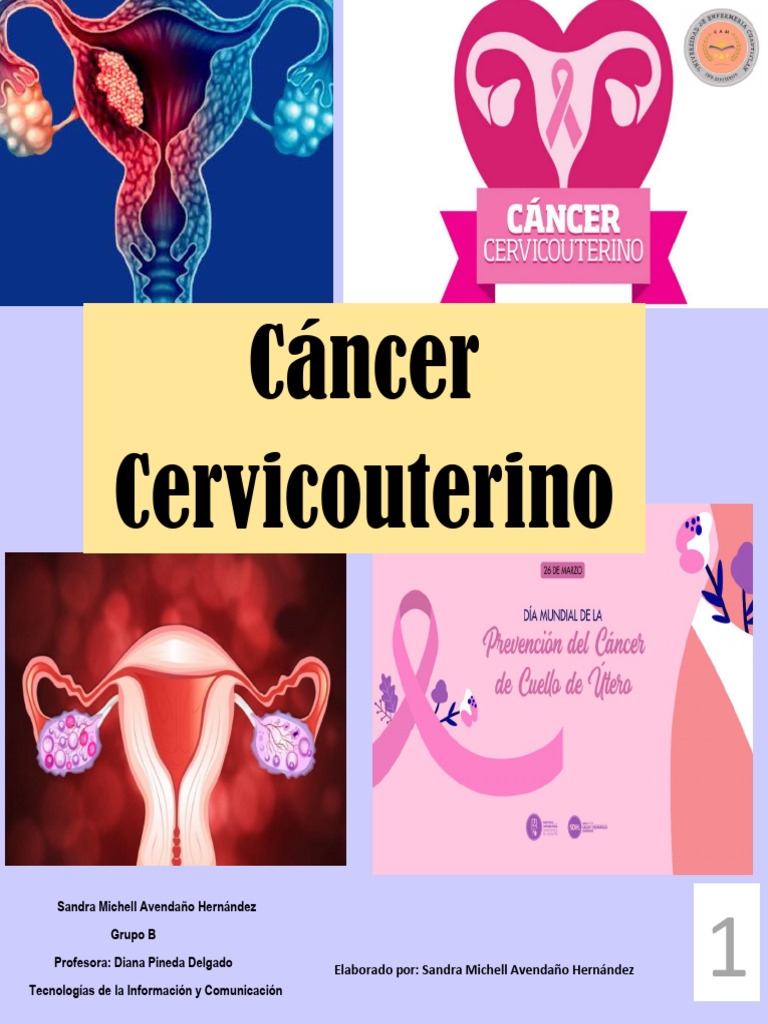 Cancer Cervicouterino 2 | PDF | Cáncer de cuello uterino | Cáncer