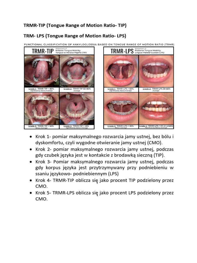 Ocena Wędzidełek | PDF