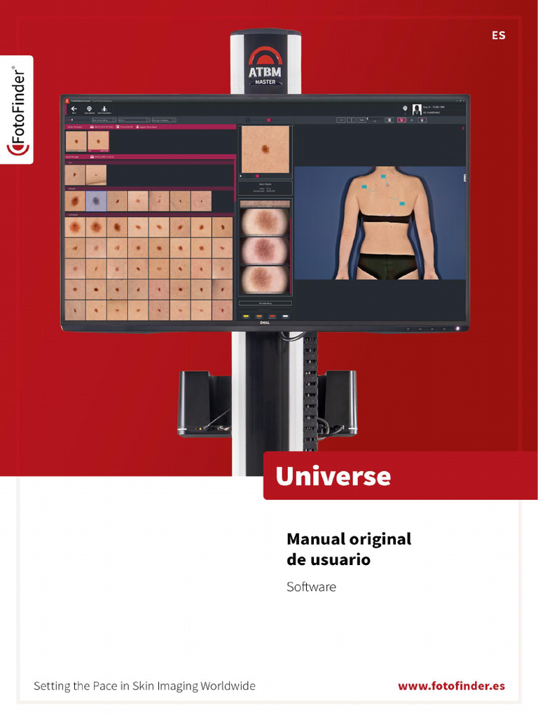 IFU FotoFinder Universe 3.5 20240626 ES | PDF | Software | Dermatología