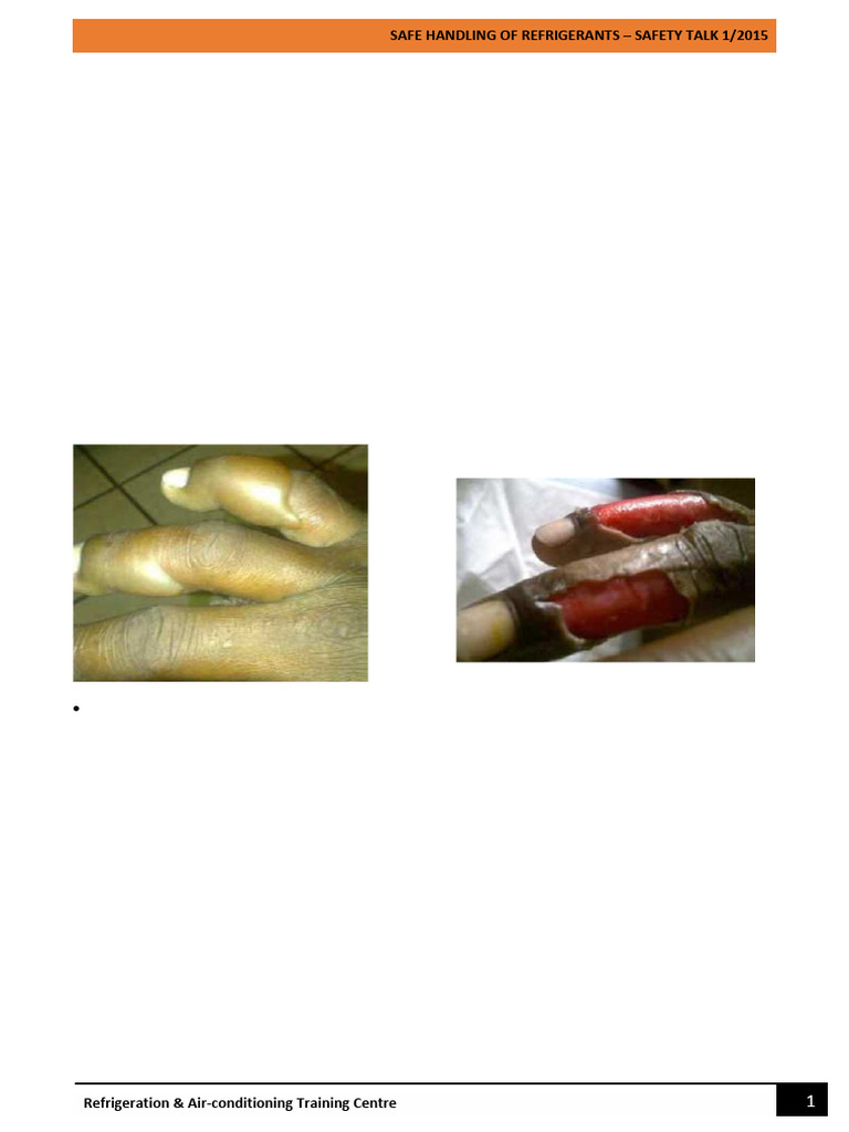 Safe Handling of Refrigerants 2015 | PDF | Ammonia | First Aid