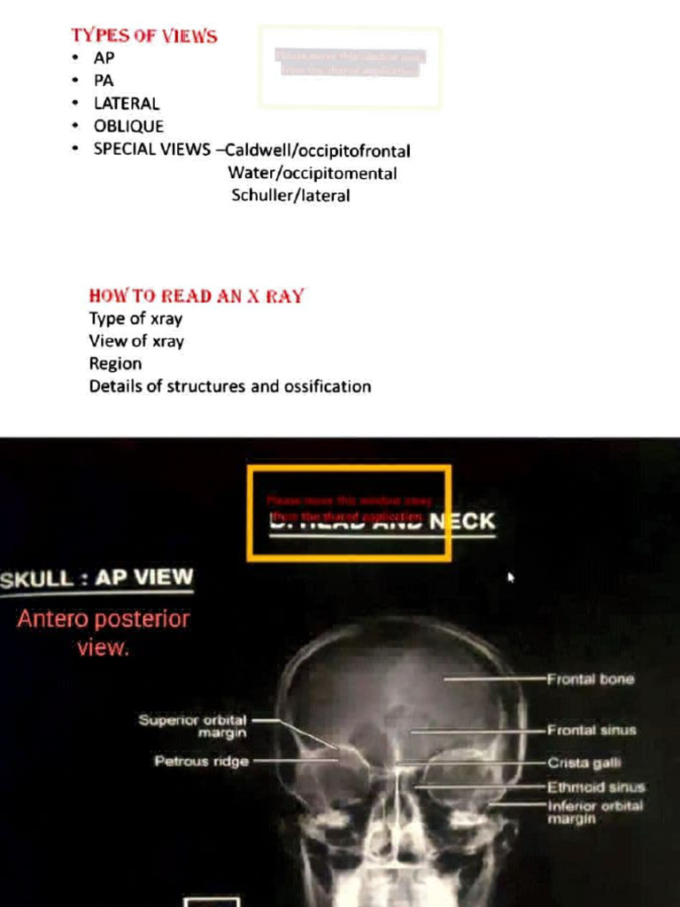 Radiological Anatomy | PDF | Radiography | Radiology