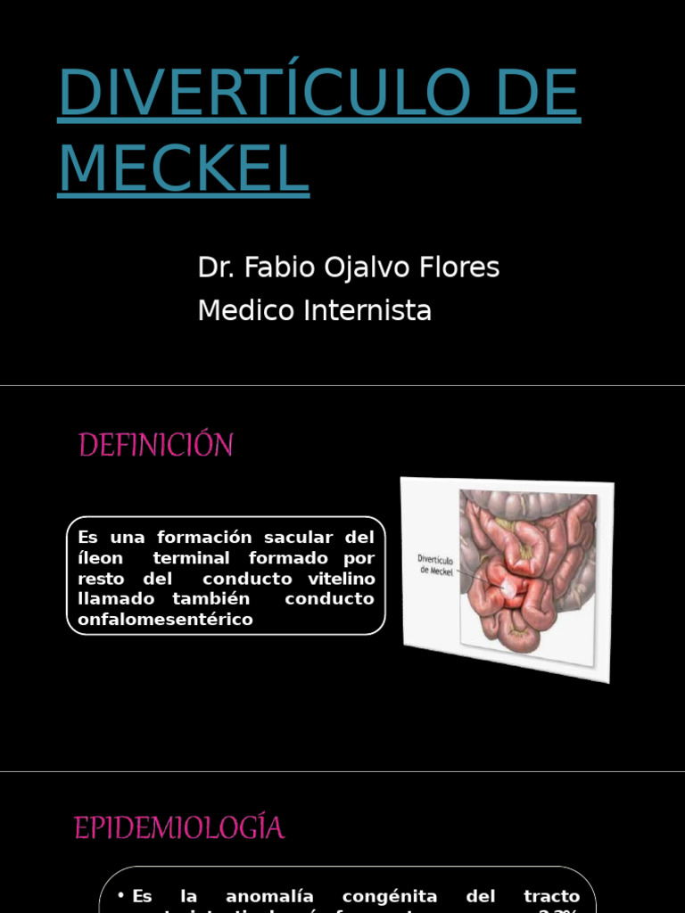 Diverticulo de Meckel | PDF | Sistema digestivo | Enfermedades digestivas