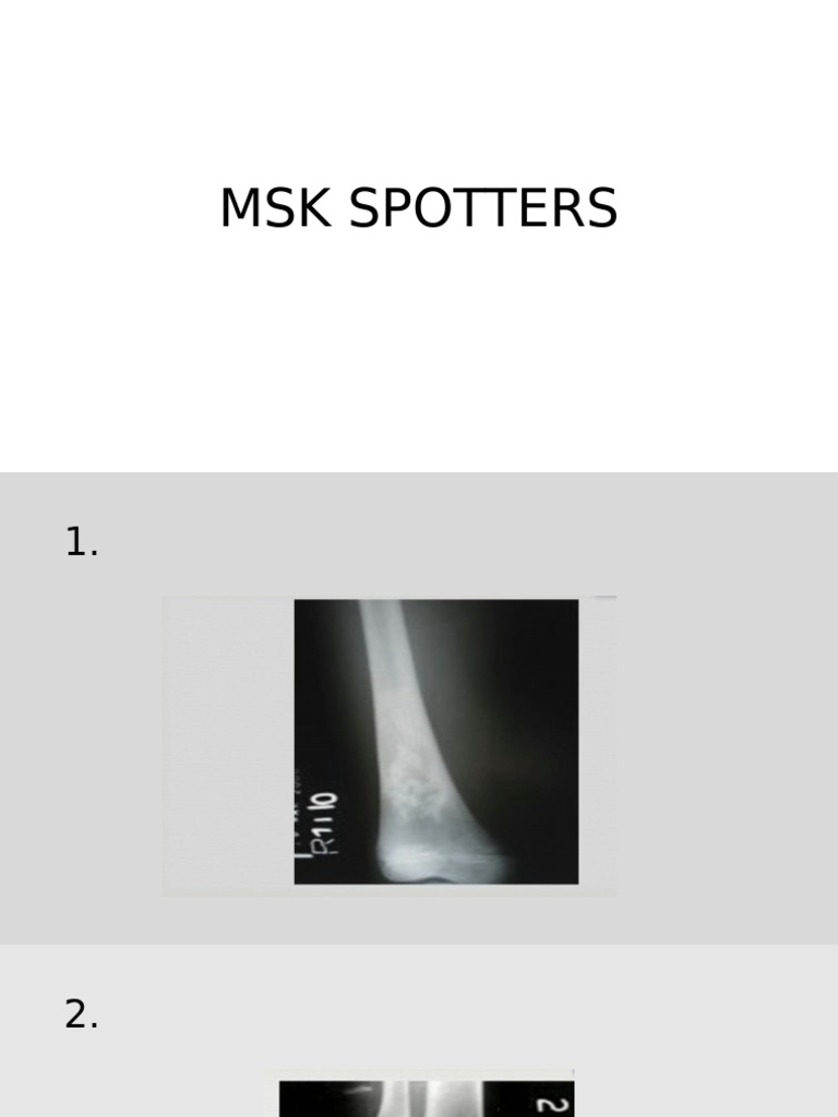 MSK Spotters | PDF