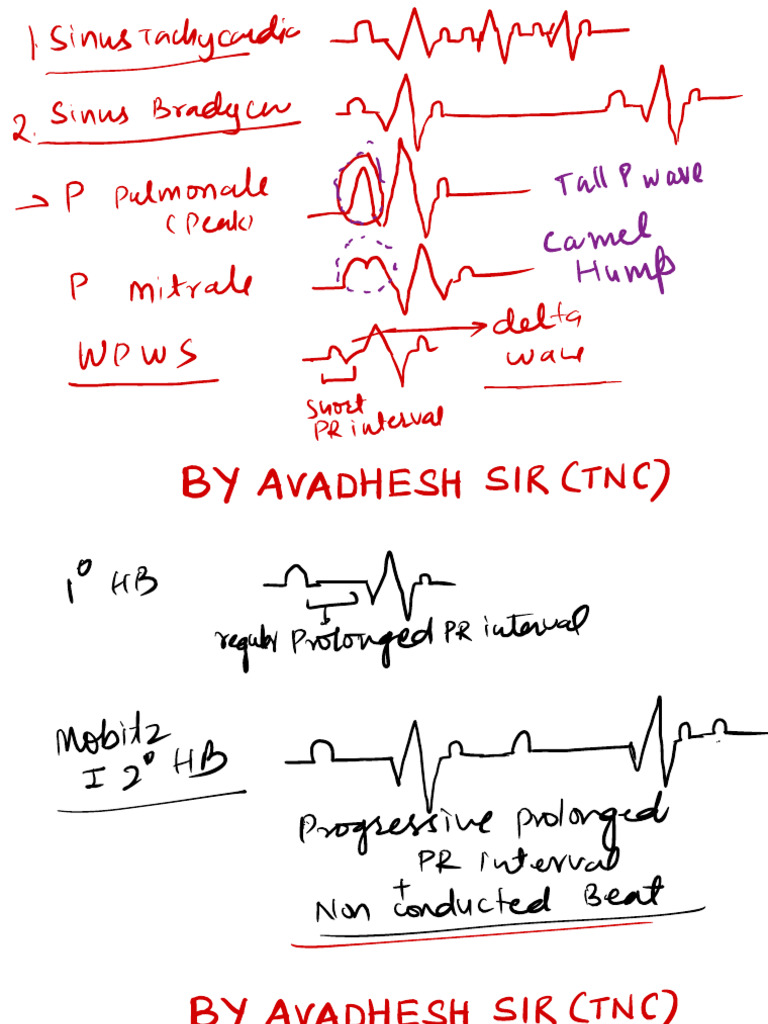 Ecg by Avadhesh Sir TNC Classes | PDF | Electrocardiography | Heart