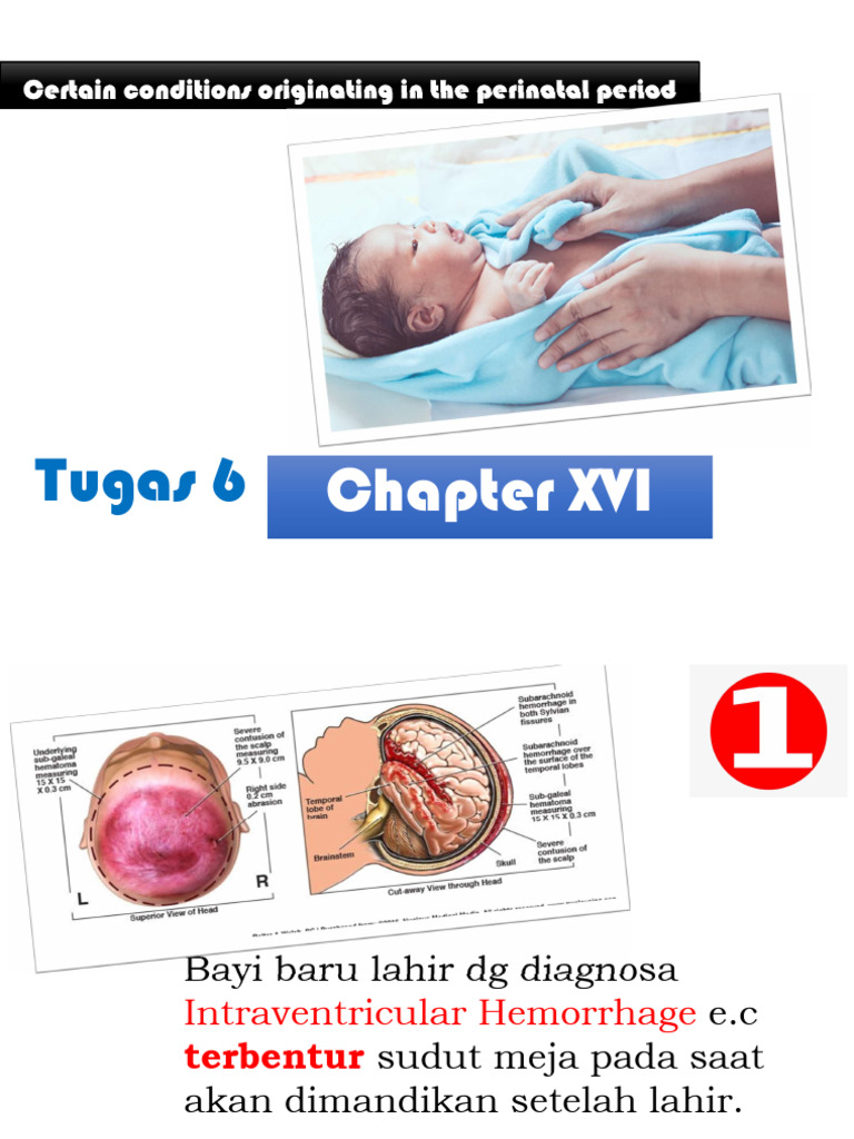7.Tugas_7_chapter_XVI_coding_perinatal | PDF