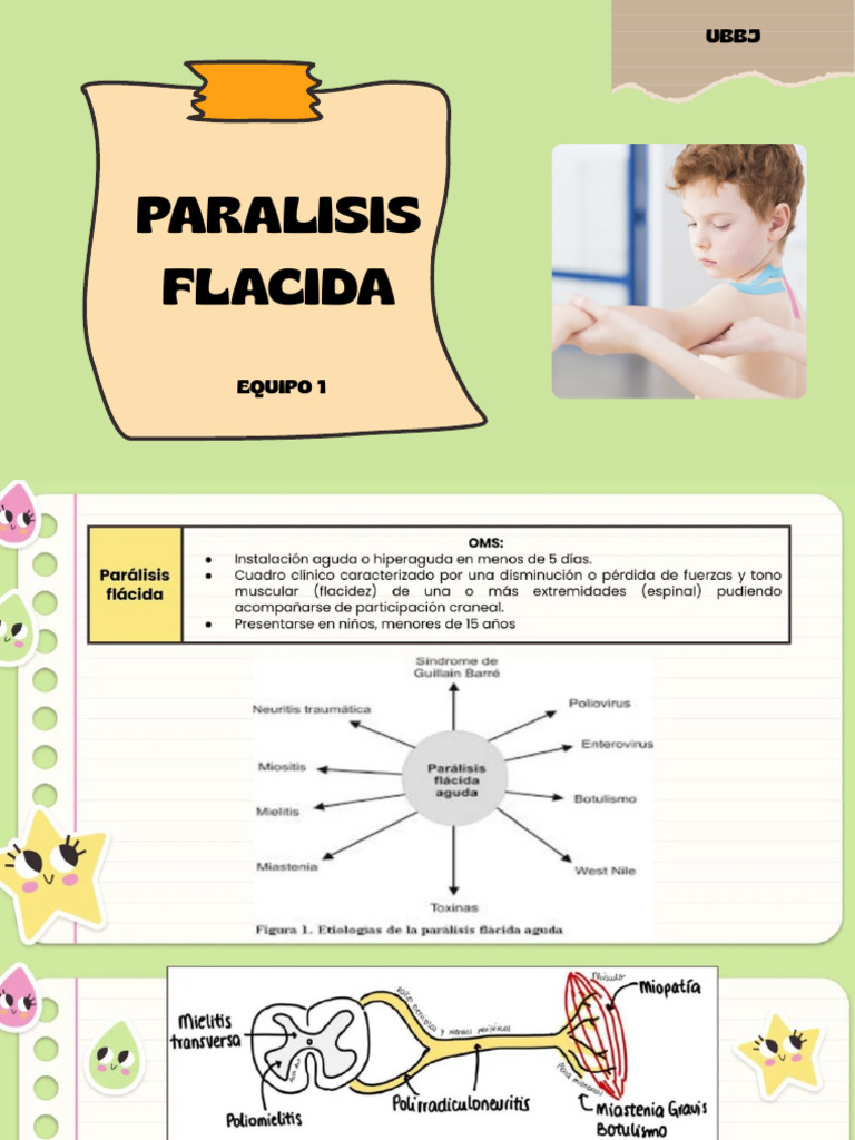 Paralisis Flacida - 20250410 - 145255 - 0000 | PDF