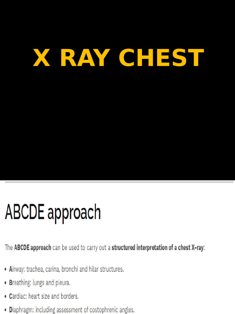 Chest X Rays | PDF
