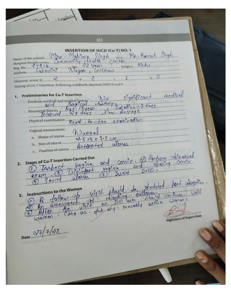 Insertion of IUCD | PDF