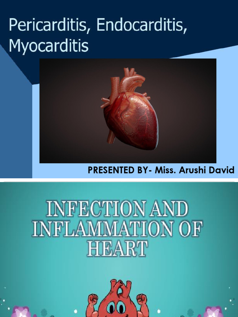 Endocarditis, Myocarditis, Pericarditis PDF | PDF