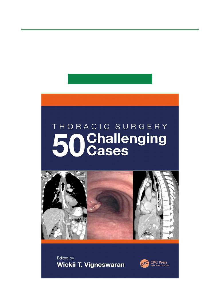 Thoracic Surgery: 50 Challenging Cases | PDF | Cardiothoracic Surgery ...