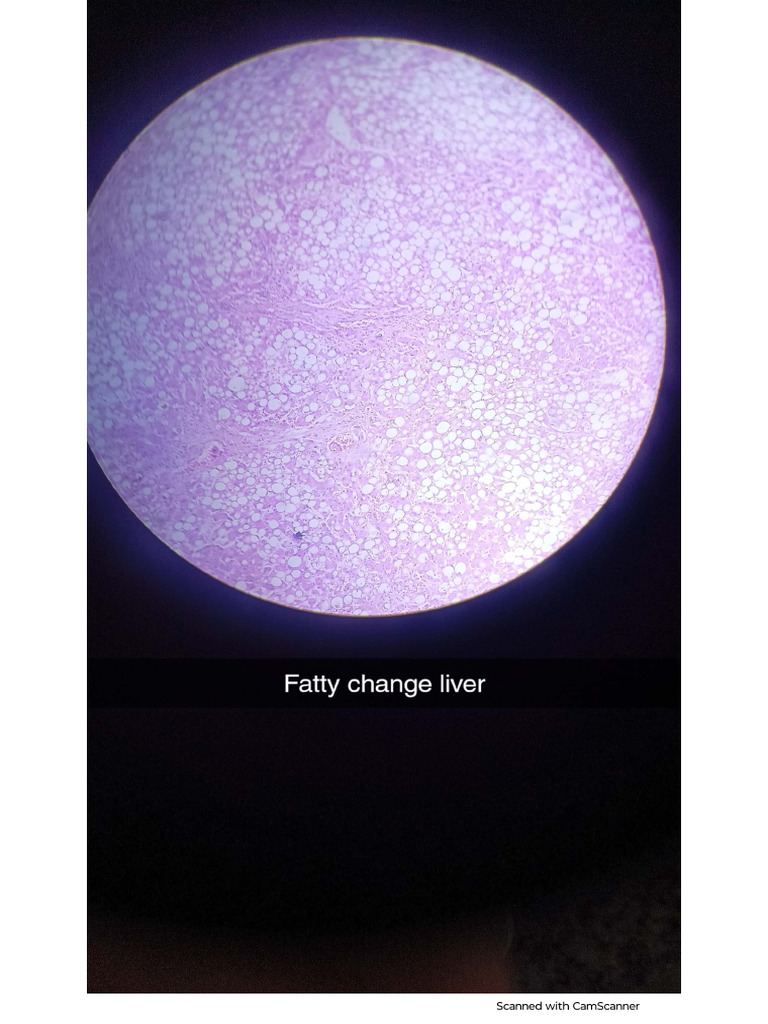 Pathology Slides Final | PDF