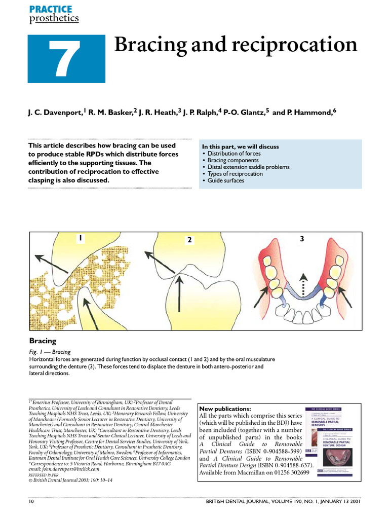 7 Bracing and Reciprocation | PDF | Dentures | Dentistry Branches
