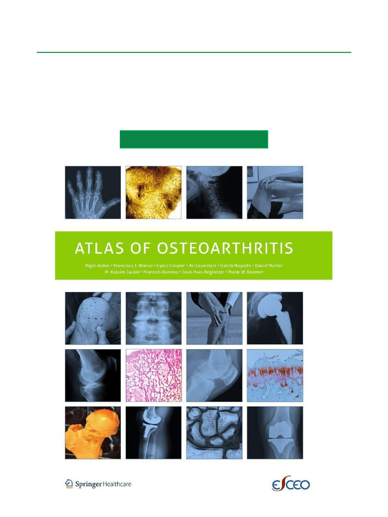 Atlas of Osteoarthritis Digital Download | PDF | Osteoarthritis | Knee