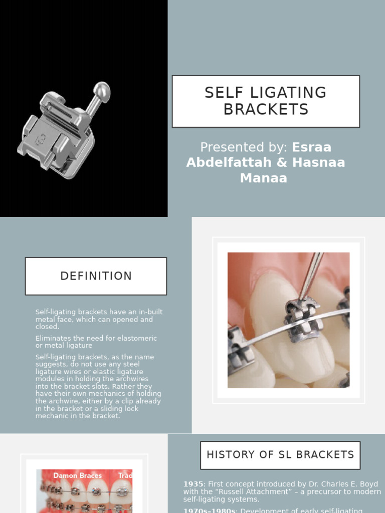 Self Ligating Braces | PDF | Orthodontics | Dentistry Branches